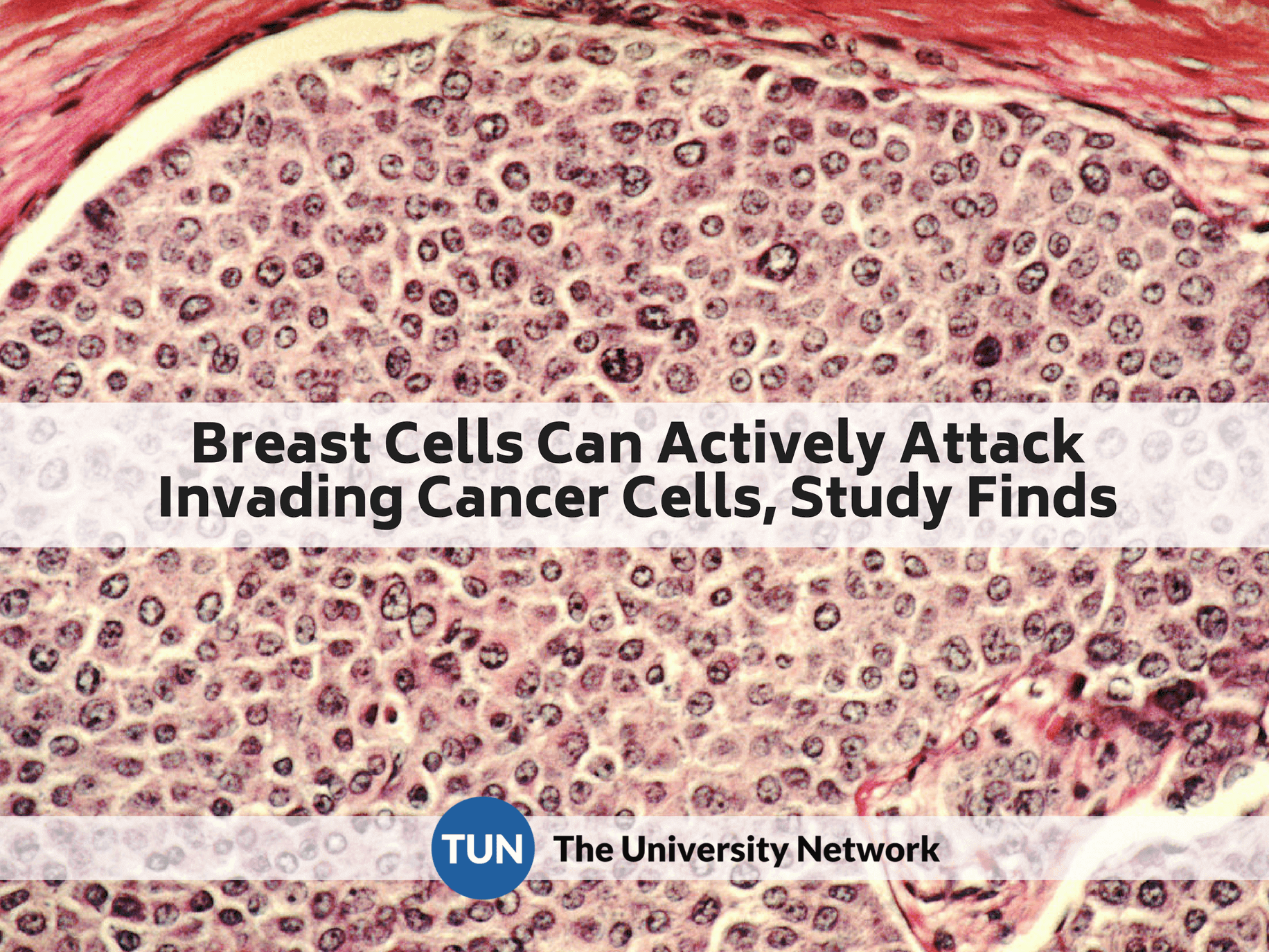 Johns Hopkins Cell Defense Cancer iPad | The University Network